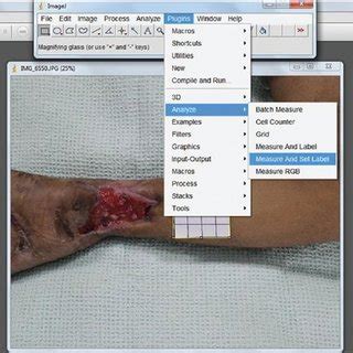 The Dimensions And Pixels Of The Marker Measured With The Rectangle Download Scientific Diagram