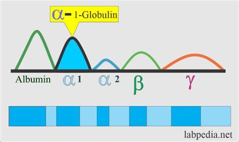 Serum Protein Electrophoresis Total Protein Albumin And Globulin