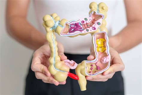 How To Diagnose Ulcerative Colitis Tests And Symptoms Ostomyonthego