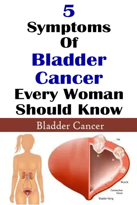 5 Symptoms Of Bladder Cancer Every Woman Should Know
