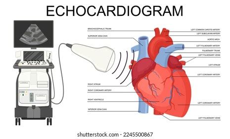 1070 Human Heart Ultrasound Stock Vectors And Vector Art Shutterstock