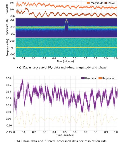 Figure 1 From Contactless Respiration Variability Detection And Accuracy Test Using Uwb Radar