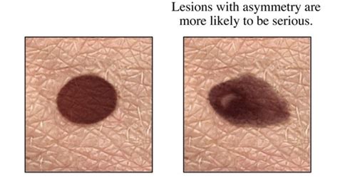 A P Lab Exam 2 Flashcards Quizlet