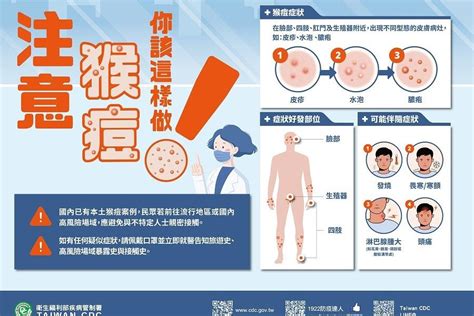 單週增5例本土m痘 創今年新高