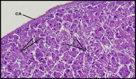 Histological Section Of The Liver In Gull Showing The Thick Capsule Download Scientific