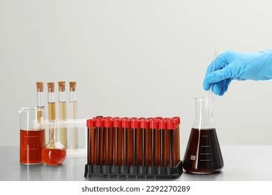 9 996 Liquid Conical Flask Images Stock Photos Vectors Shutterstock