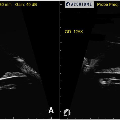 Principle Of The Multi Wave Lateral Shearing Interferometry Download Scientific Diagram