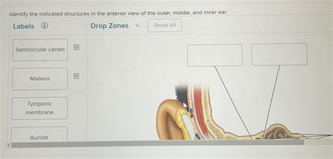 Solved Identify The Indicated Structures In The Anterior