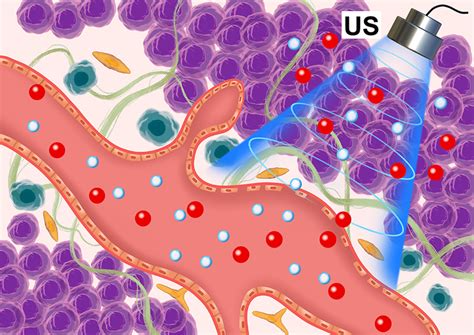Schematic Diagram Of The Microbubble Ultrasonic Cavitation Pretreatment Download Scientific