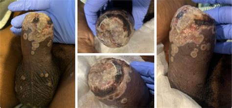 Interval Physical Exam Findings On Day Of Admission 5 6 Download Scientific Diagram