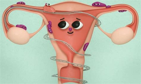 علت ابتلا به دیسپلازی دهانه رحم چیست؟ آزمایشگاه تخصصی کوثر مشهد