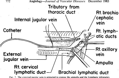 Right Lymphatic Duct Lymphatic Thoracic Duct Duct