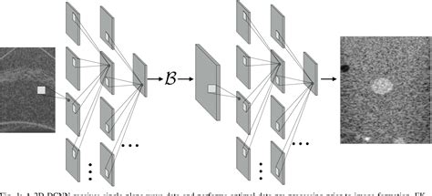 Figure 1 From Single Plane Wave Imaging Using Physics Based Deep
