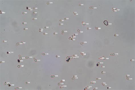 Detecting Circularelliptical Shape With Python Opencv Or Any Other Lib Stack Overflow