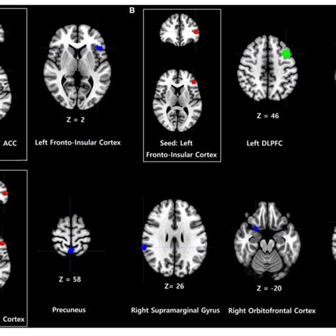 Increases And Decreases In Dorsal Anterior Cingulate Cortex Dorsal