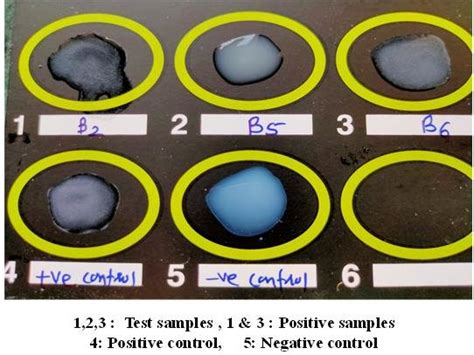 Detection Of Bovine Rotavirus By Latex Agglutination Test Download