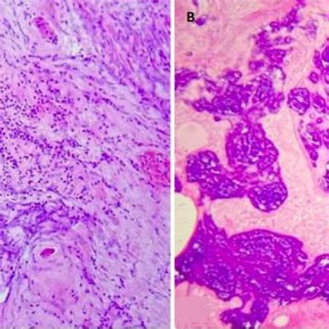 A Non Contrast Ct Scan Showing Extensive Calcification Of The Download Scientific Diagram