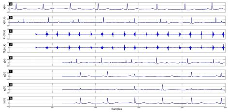 Electronics Free Full Text Efficient Fpga Based Architecture Of The