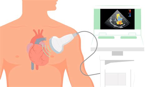 Afib Tests Pcna Atrial Fibrillation