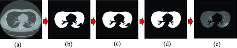 Shows The Workflow Of Lung Segmentation In A We Show An Original