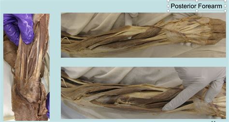 Extensor Muscles Of The Forearm Diagram Quizlet