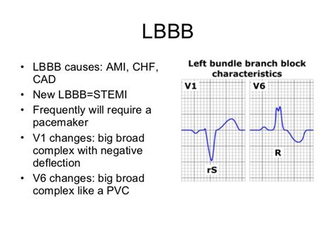 12 Lead Ecg