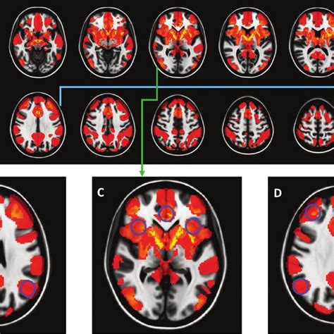 Normative Functional Connectivity Networks For Dbs And Non Invasive Download Scientific Diagram