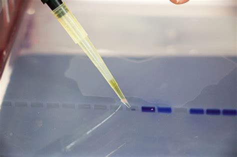 Agarose 젤 전기 이동 법은 젤 전기 이동 법에서 생화학 분자 생물학 유전학 그리고 임상 화학 실험실에서 사용 되는 방법입니다 Dna에 대한 스톡 사진 및 기타 이미지
