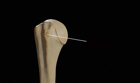 Structures Of The Arm Flashcards Quizlet