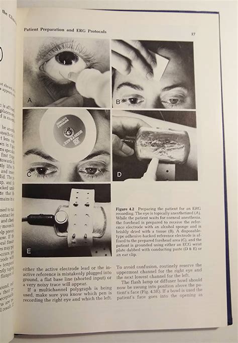 Visual Electrodiagnostic Testing A Practical Guide For The Clinician By Carr Ronald E And Irwin