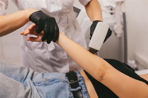 Keloid Scar Treatment Natural Vs Medical Remedies