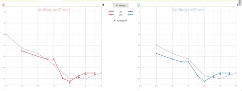 Best Phonak Self Fitting For Severe To Profound Loss Hearing Aid Self Fitting And Adjusting