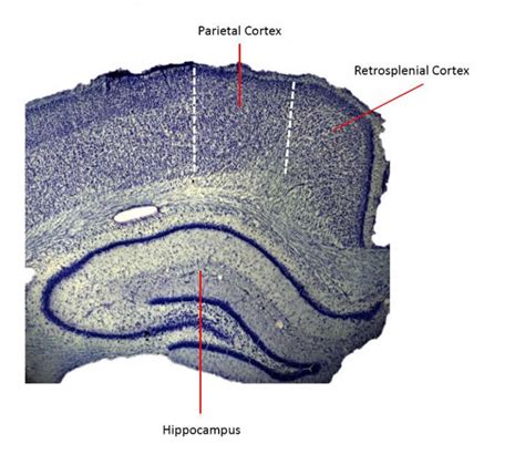 Retrosplenial Cortex Plays Important Role In Spatial Mapping And