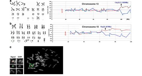 Detection Of An Unknown Origin As Supernumerary Marker Chromosome