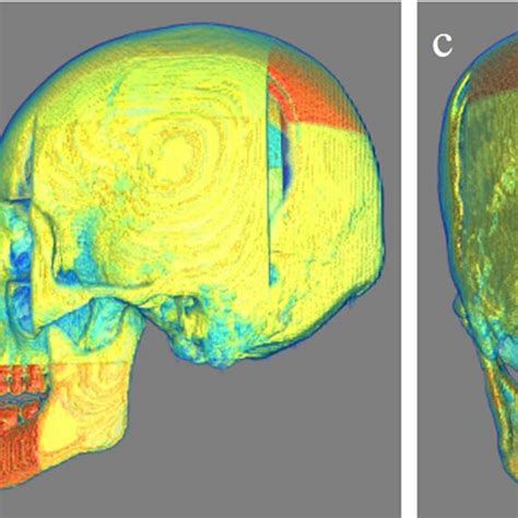 An Example That Our Mil Model Predicted Appropriately A The Frontal Download Scientific