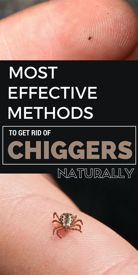 How To Get Rid Of Chiggers In Your Grass Arvigy
