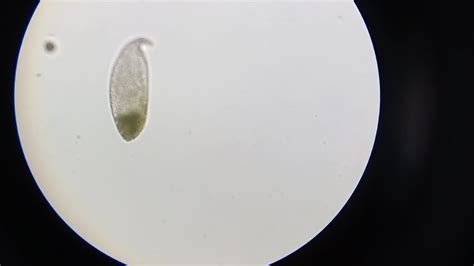 Could Anyone Help Me Identify This Rmicroscopy