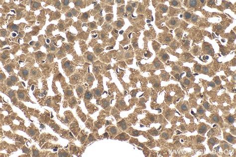 Cad Antibody 16617 1 Ap Proteintech