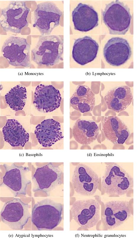 Figure 3 From Automatic Classification Of Leukocytes Using Deep Neural