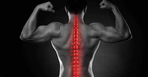 How Do You Fix Cervical Radiculopathy San Antonio Tx Spine Doctor