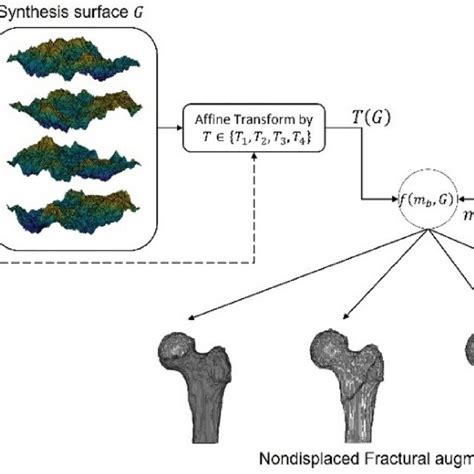 Workflow Of The Fractural Augmentation The Position Of The Synthesis