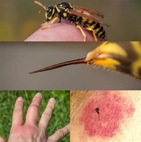 Какво да правите ако ви ужили стършел Първите 5 минути могат да ви спасят живота съвет на