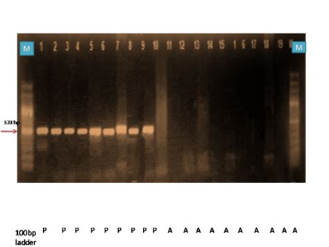 Germplasm Evaluation And Characterization Of Slow Rusting Resistant