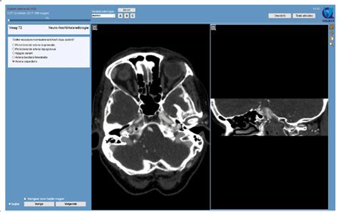 Example Of A Volumetric Image Based Test Item In The Dutch Radiology Download Scientific