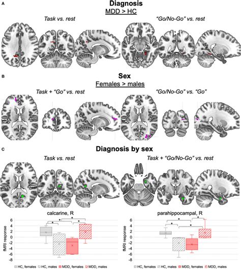 Sexual Dimorphism In The Brain Correlates Of Adult Onset Depression A