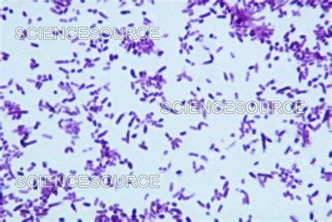 Ochrobactrum Anthropi Bacteria Lm Stock Image Science Source Images