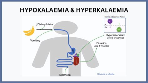 Hypokalaemia And Hyperkalaemia Explained Youtube