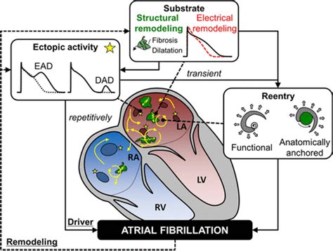 Translational Challenges In Atrial Fibrillation Circulation Research