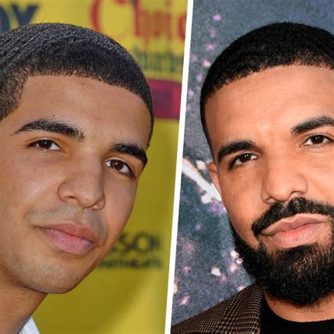 Drake Before And After