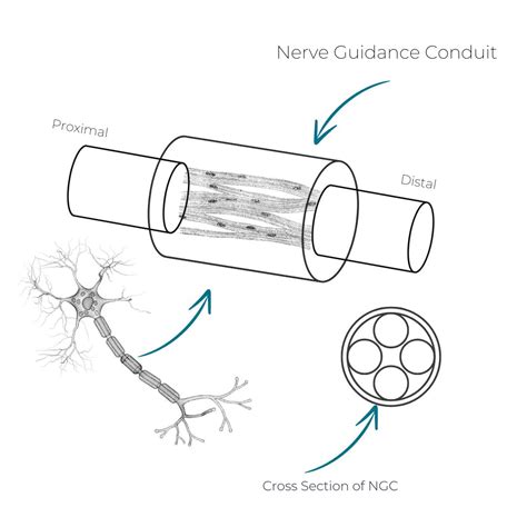 Advancing Peripheral Nerve Regeneration Leveraging Plasma Surface Activation For Biomaterial